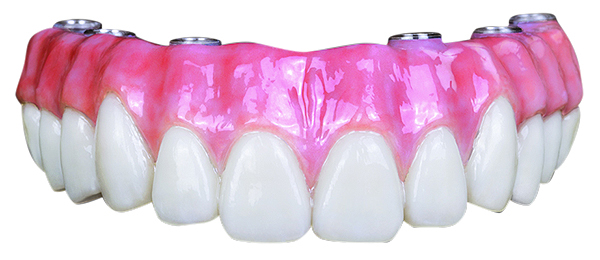 Glidewell: Partnering With Dentists for Comprehensive Patient Care ...