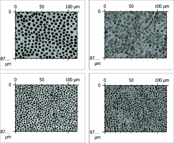 Effect of a Stannous Fluoride Toothpaste Stabilized With Nitrate and ...