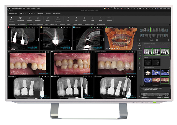 DTX Studio™ Software Suite Has Transformed Patient Experience for ...